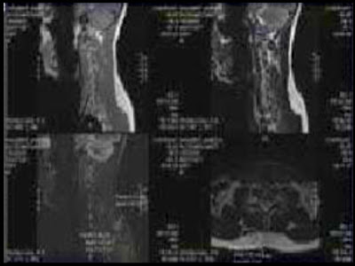 Targeted Individuals Canada: James Walbert