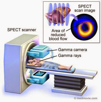 My 29 Lives: Nuclear Heart Scan