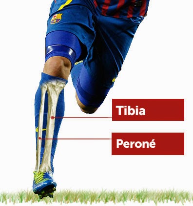 Dr. Luis Cotillo Herrera Traumatólogo Especialista en Rodilla: LAS ...