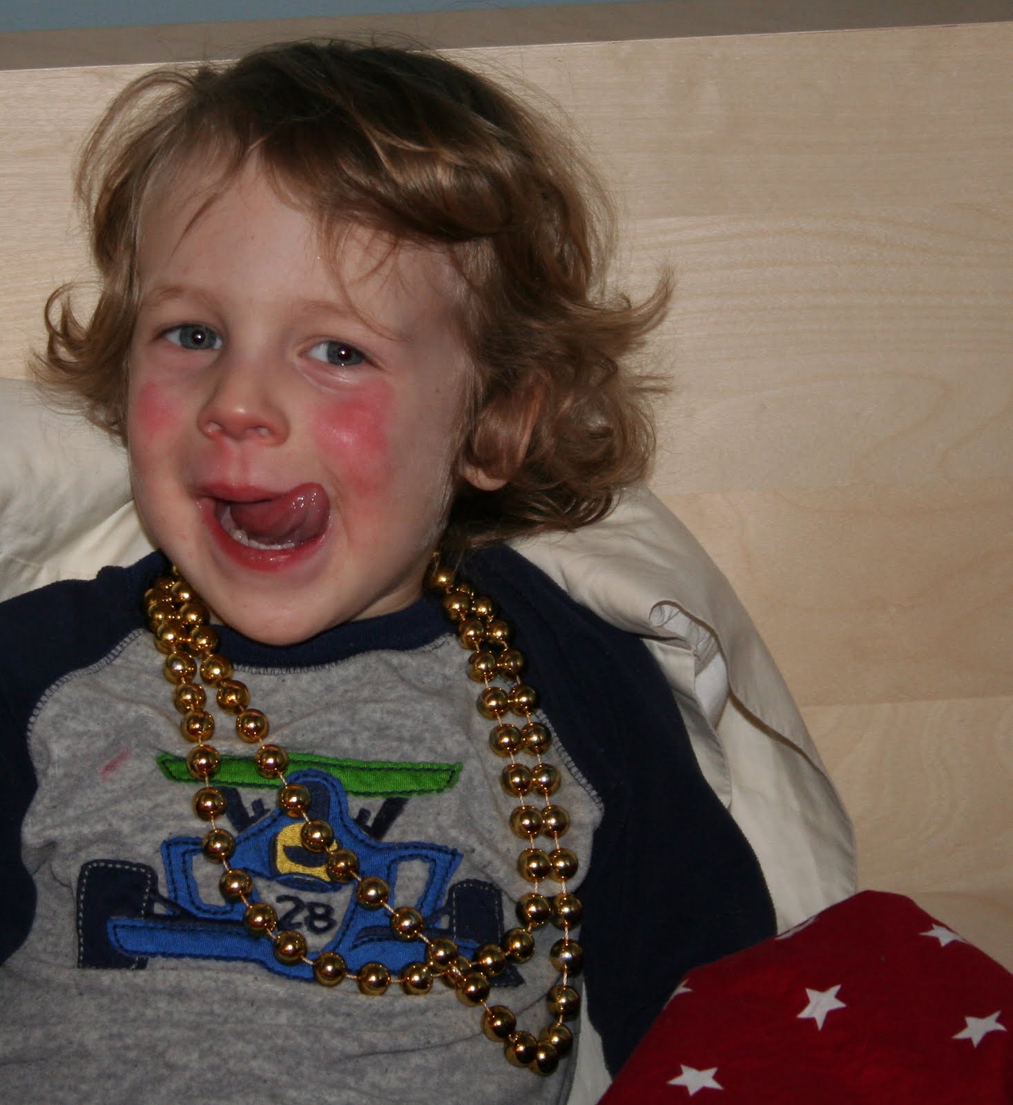 zman and gparker: Classic Parvovirus B19 Infection - otherwise known as ...