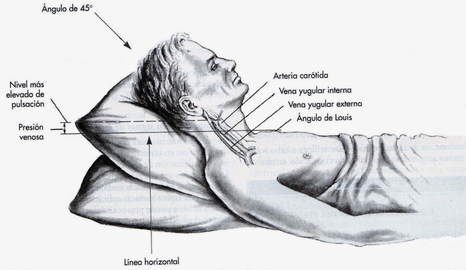 Detrás de la consulta: Semiología del Pulso Venoso.