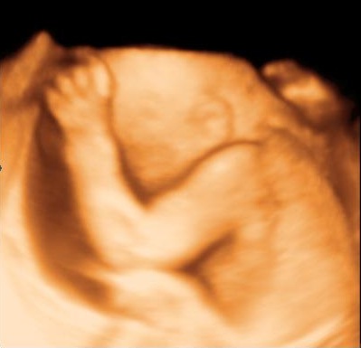 Our Nine Month Project: 3D Ultrasound @ 26 weeks