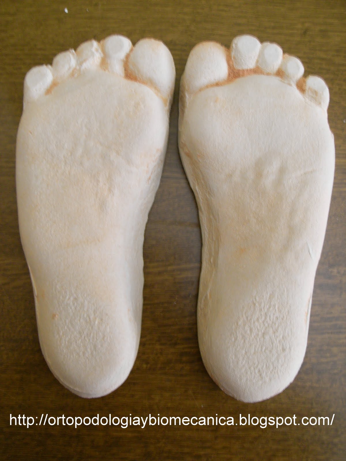 Ortopodologia y Biomecanica : “GAIT PLATE”. TRATAMIENTO METATARSO ADUCTO