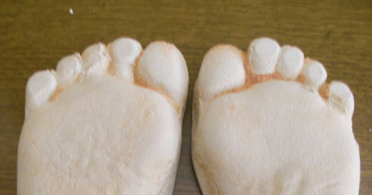 Ortopodologia y Biomecanica : “GAIT PLATE”. TRATAMIENTO METATARSO ADUCTO