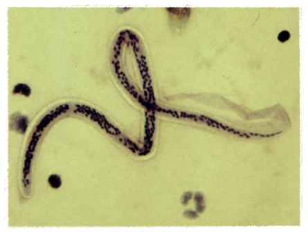 Gambar Macam-macam cacing | Dunia Binatang