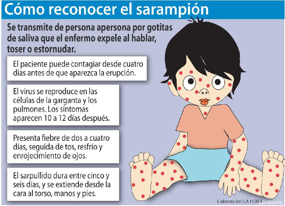 ADULTO MAYOR . MÁS VIDA A LOS AÑOS .: SARAMPIÓN