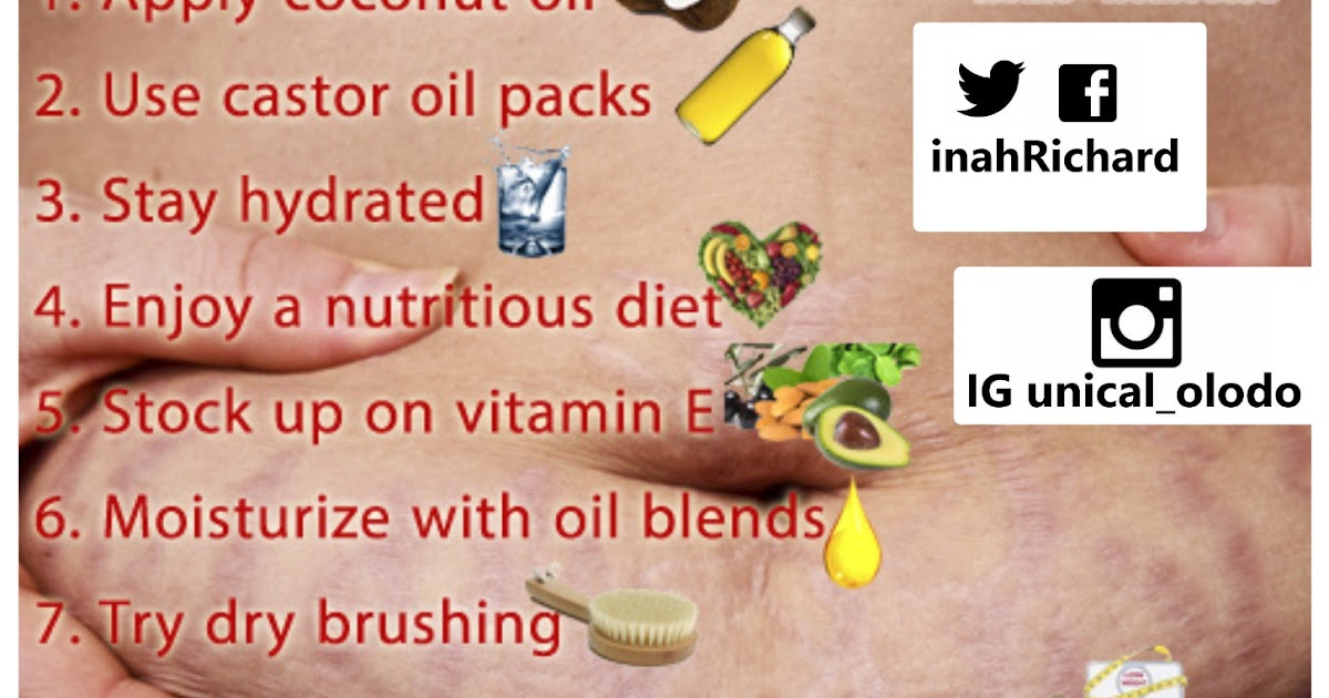 ways to stop stress marks