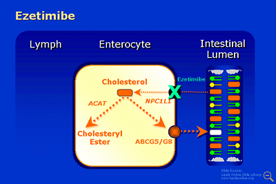 MRCP UK Revision: Ezetimibe