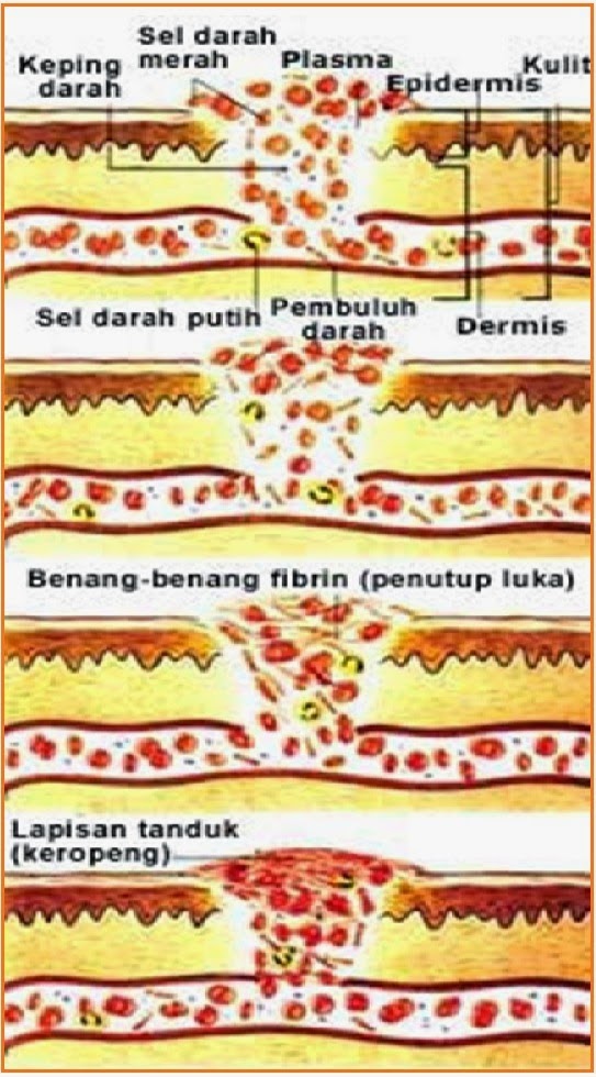 Mengenal Proses Terjadinya Pembekuan Darah | 1001 Catatan, Cara dan Tips