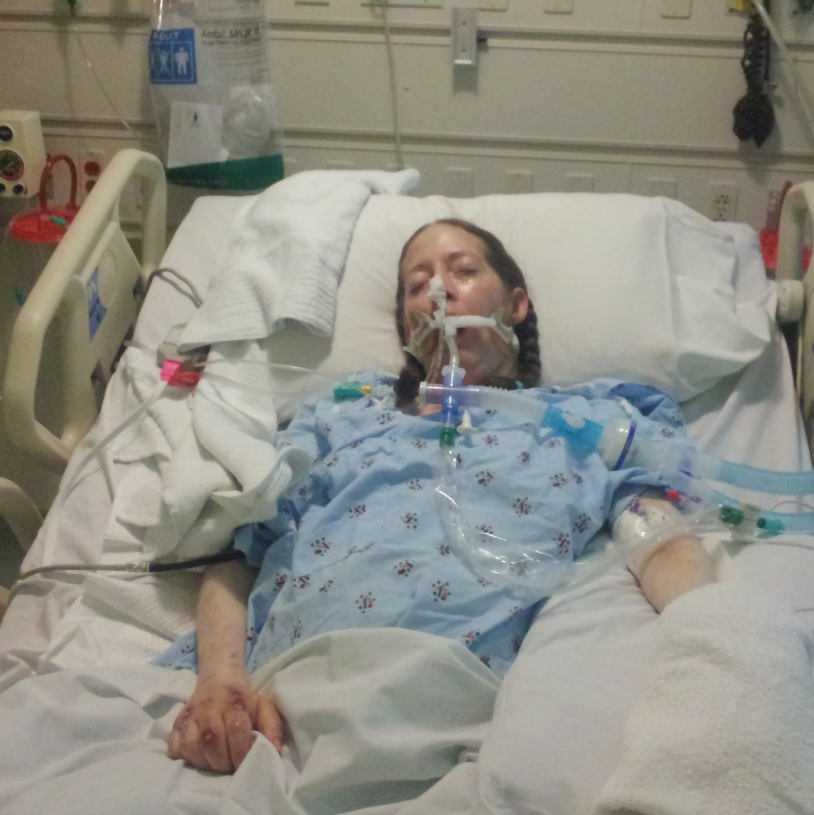 Coma Chameleon: My Recovery Chronicles: August 2015