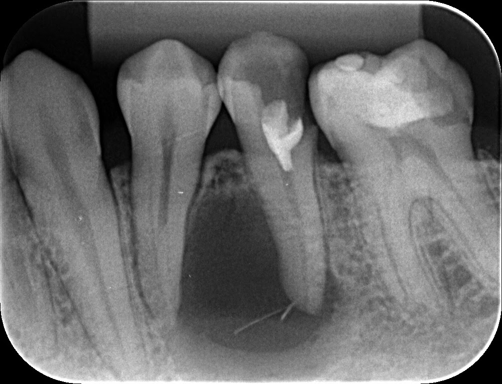 "Te vejo por dentro": 2014