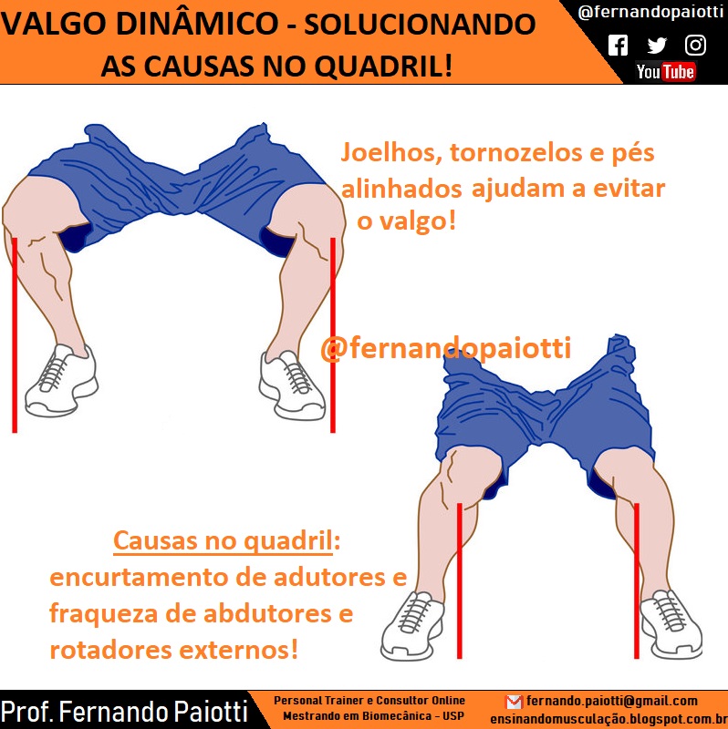 VALGO DINÂMICO – SOLUCIONANDO AS CAUSAS NO QUADRIL!