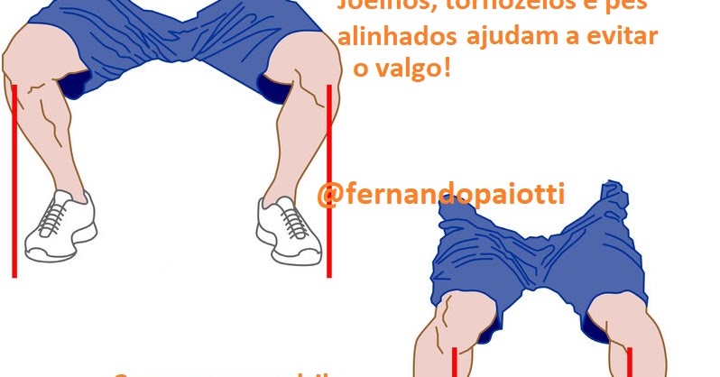 VALGO DINÂMICO – SOLUCIONANDO AS CAUSAS NO QUADRIL!