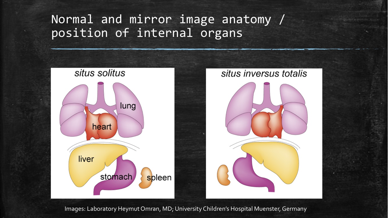 Once Upon A Prayer: Lily's Intestinal Malrotation
