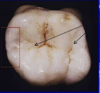 morfologia dental : morfologia