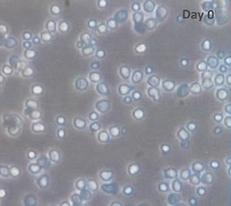 Multiple Sclerosis Research: Cognitive deficit research