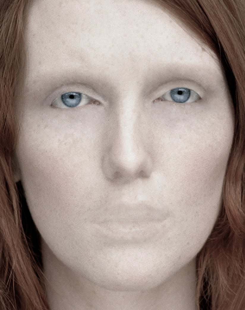 Soft bloody nose: Ivonne Thein - Thirty two kilos photoshoot