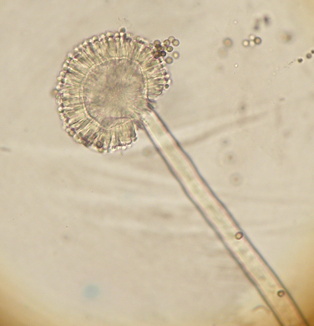 ATLAS MICOLOGIA: ASPERGILLUS NIGER