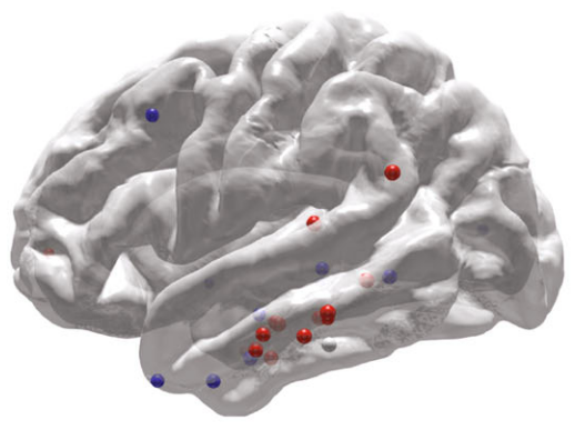 The Neurocritic: Automatically-Triggered Brain Stimulation during ...