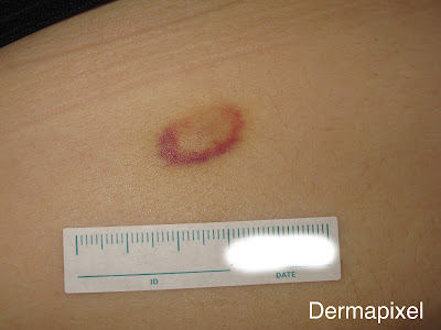 Dermapixel: mayo 2018