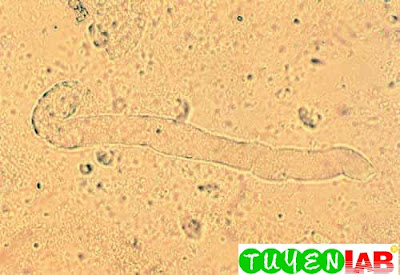 Atlas of Casts in urine | Free Medical Atlas