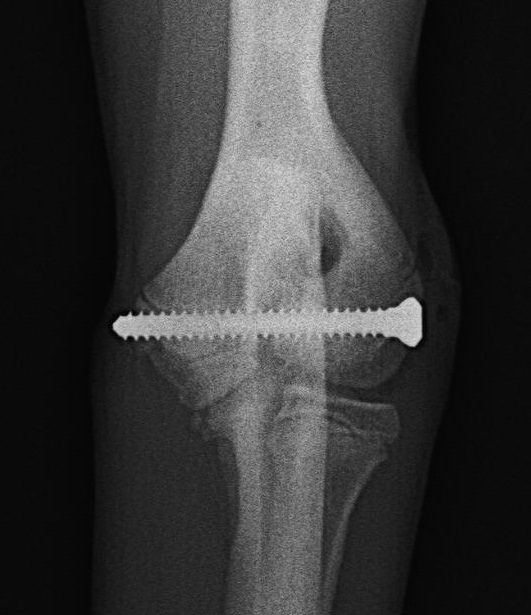 Traumatologia y Cirugia Ortopedica Veterinaria: Lateral process ...