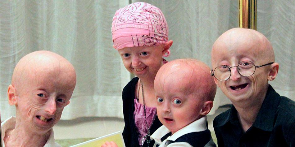 LA BIOLOGÍA EN EL CINE Y LAS ARTES: EL CURIOSO CASO DE BENJAMIN BUTTON ...