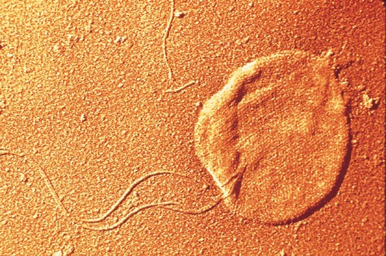 BioRaquel: ARQUEOBACTERIAS