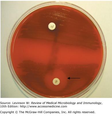 OPTOCHIN TEST - Microbiology Laboratory Turkey