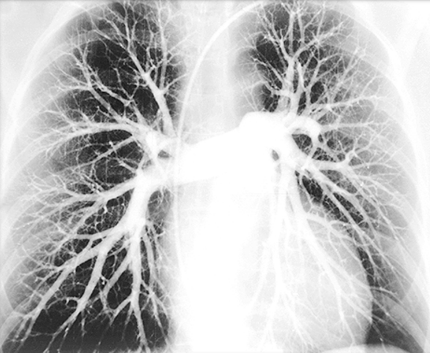 Tutor's Notes: general, cardiovascular, respiratory and renal ...