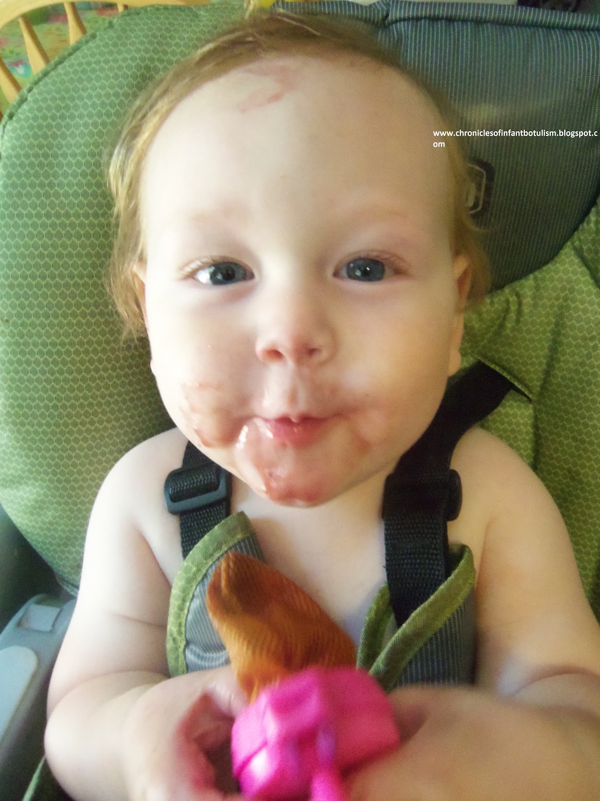 Chronicles of Infant Botulism