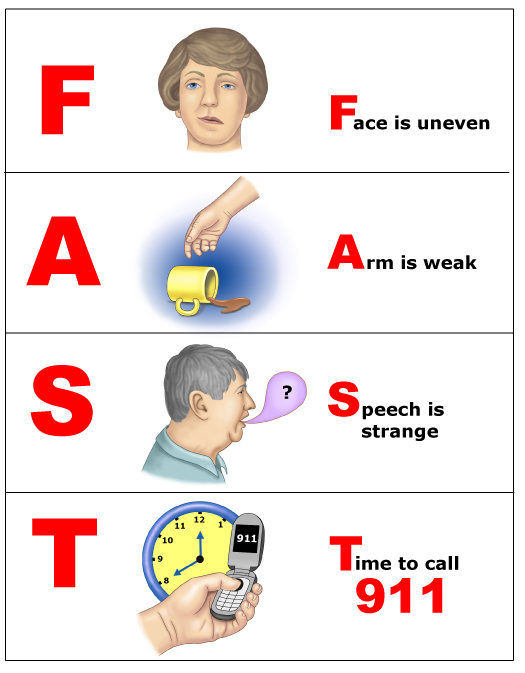 Cerebrovascular Accident: Hemorrhagic Stroke - The Basics