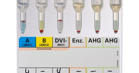 Clase Factor Rh y sistema Kell
