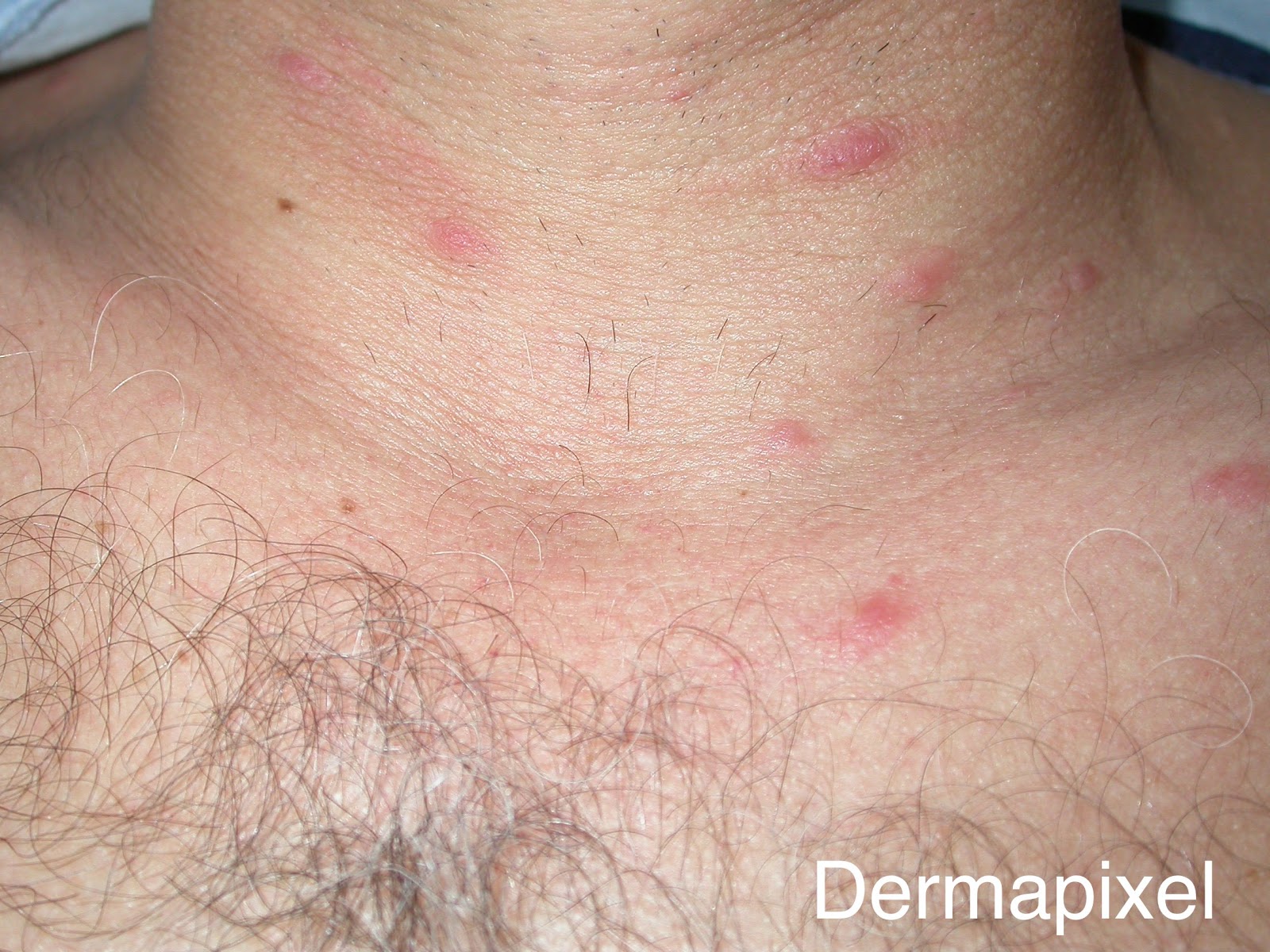 Dermapixel: febrero 2018