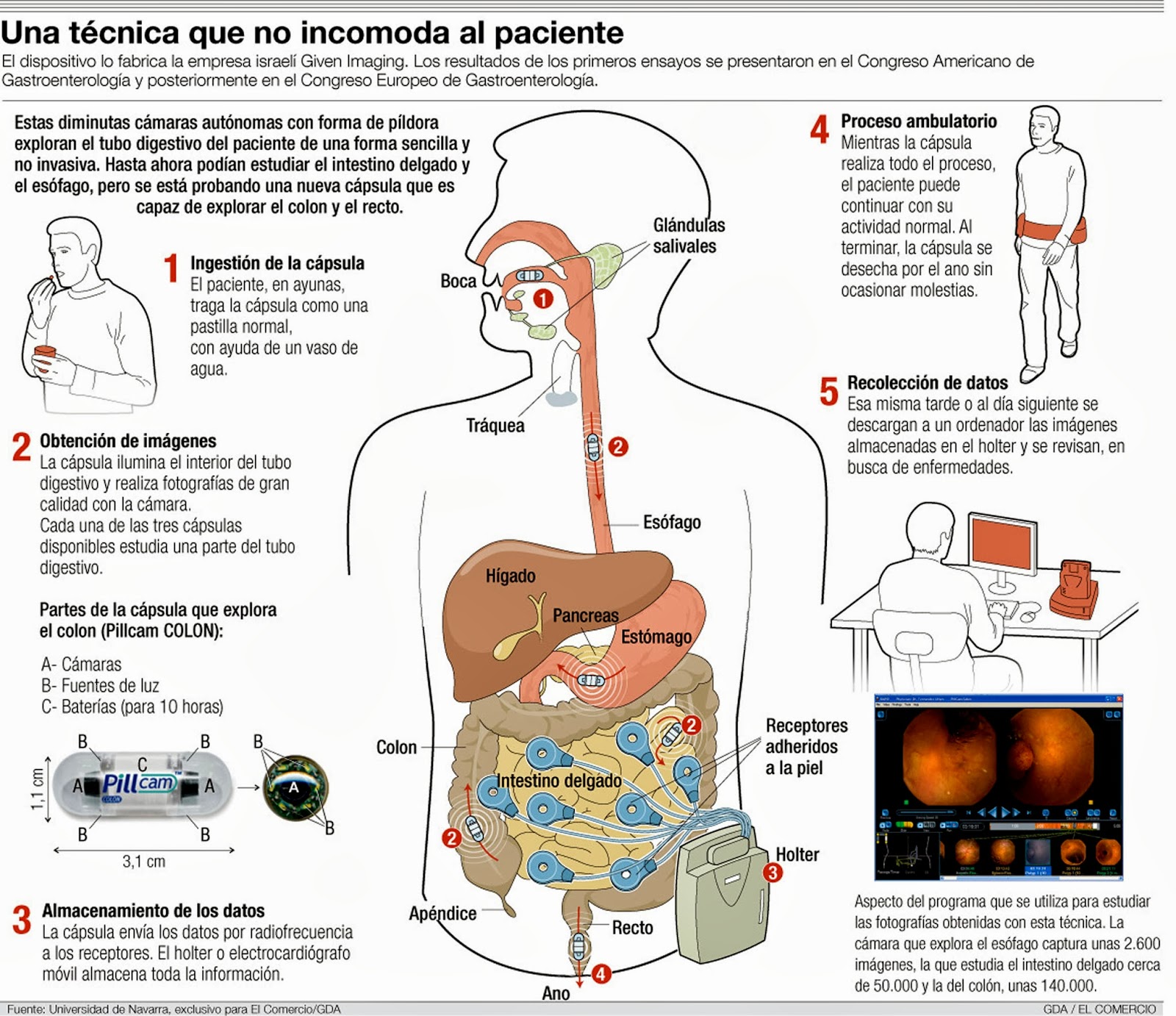 MEDICINA - ENDOSCOPIA DIGESTIVA ALTA : MEDICINA - ENDOSCOPIA DIGESTIVA ALTA