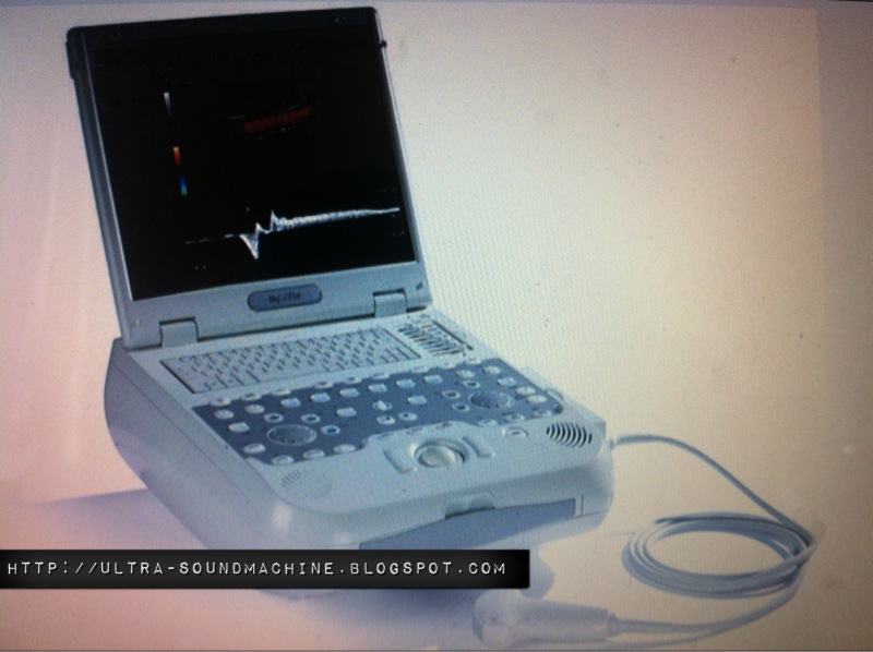Ultra Sound Machine: Biosound Caris Portable Ultrasound