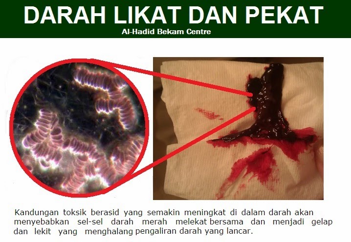 AL-HADID BEKAM CENTRE: DARAH LIKAT DAN PEKAT