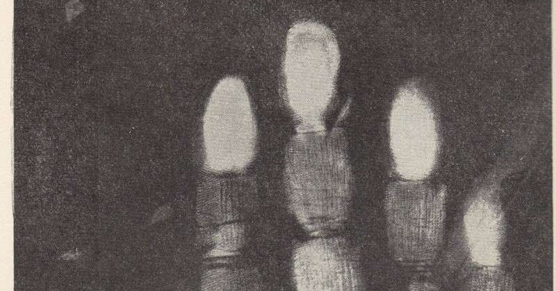 Dictator Adolf Hitler Palm Reading Palmistry ~ INDIAN PALMISTRY | PALM ...