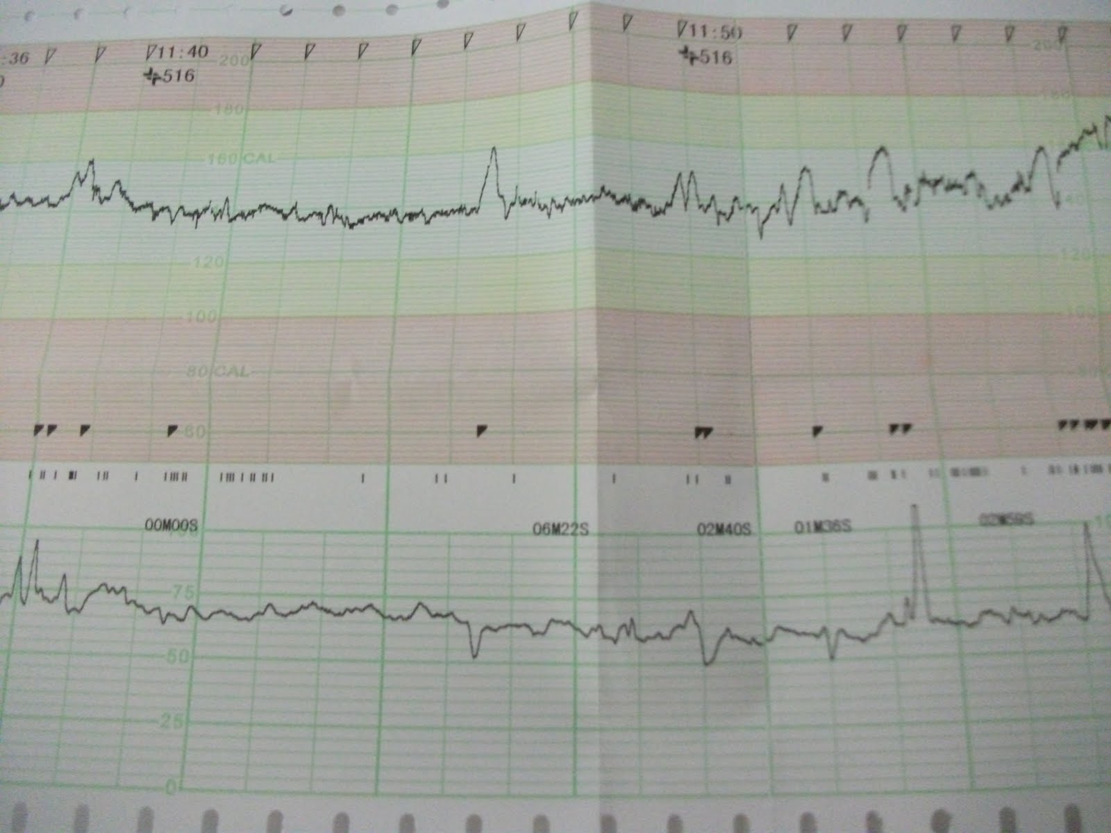 Mamãe das Isa's...: Cardiotoco- Preparativos Quarto