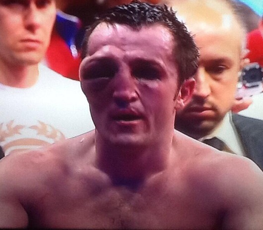 Good Lord, Boxer Denis Lebedev's Face Resembles a Sleestak's after Last ...