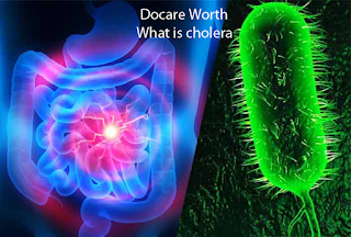Cholera: Causes, Symptoms, Diagnosis, complications