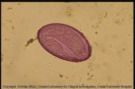 Atrigino vegus XII-1 Blog: gambar telur cacing
