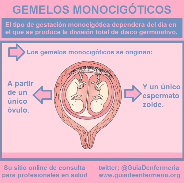 GEMELOS MONOCIGÓTICOS - GUÍA DE ENFERMERÍA