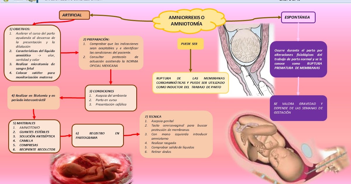 EVIDENCIAS GINECOLOGÍA & OBSTETRICIA 2017: AMNIORREXIS Y EPISIOTOMIA