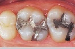 DENTISTAS E HIGIENISTAS DE ATENCION PRIMARIA. Hospital General de Elche ...