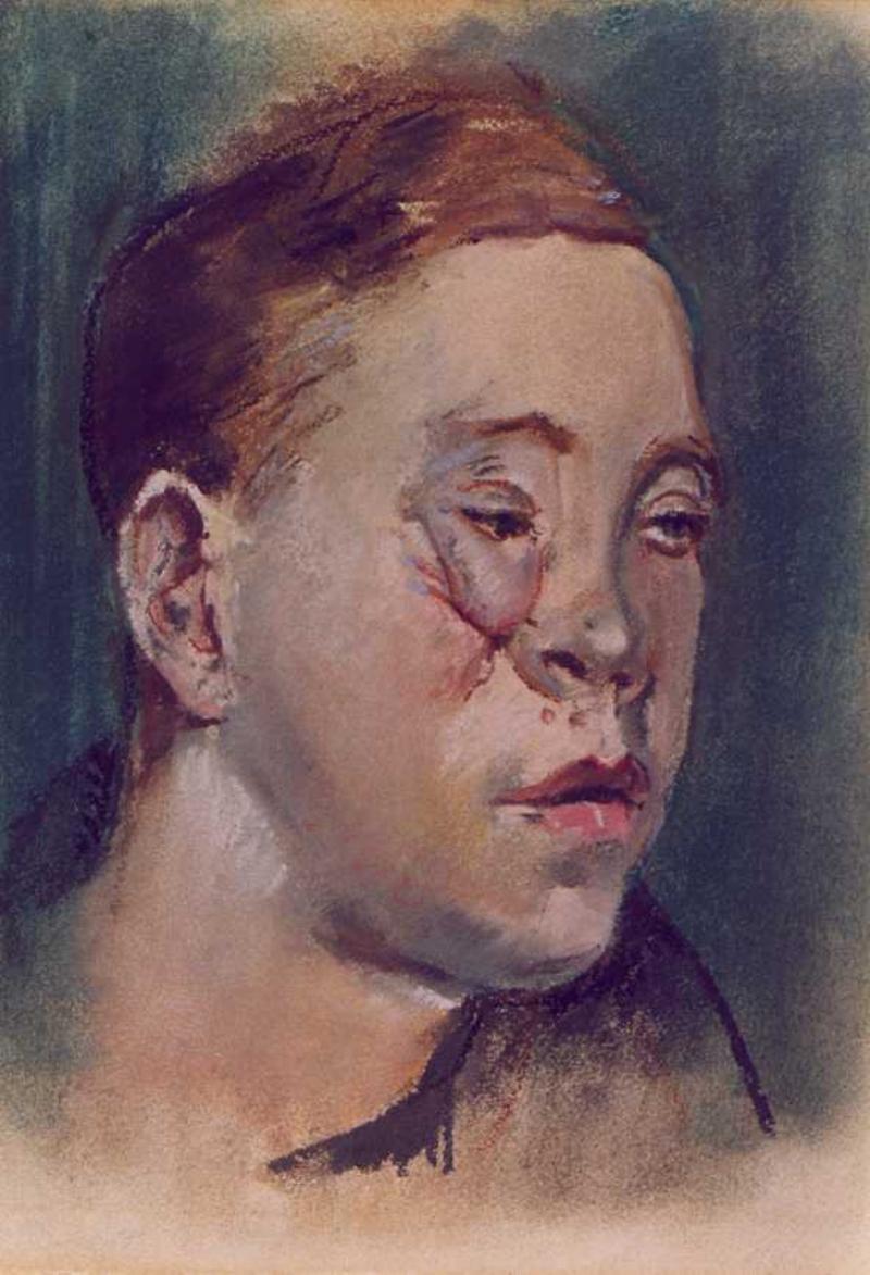 deep space daguerreotype: Henry Tonks - Portraits of Wounded World War ...