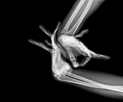 ArtPlastoc: 572-MARC FERRANTE, "JEUX DE MAINS", RADIOGRAPHIES, 2005-2010