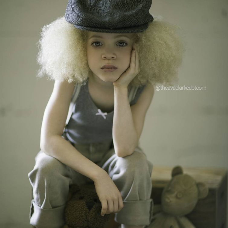 Ava Clark - A Young Girl is an albino, come to be an african american ...