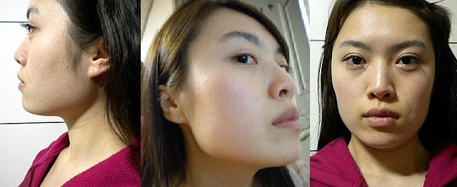 我是小潔... I'm Jie...: (Korean Girls Plastic surgery) It really shake me ...