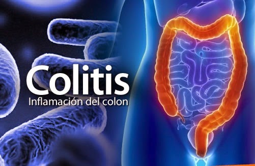 SaludYuc: junio 2014